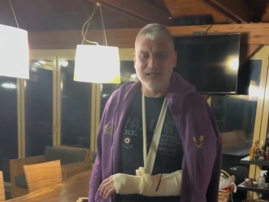 RUKA MU U GIPSU: Čedomir Jovanović pretučen? | Slobodna Bosna